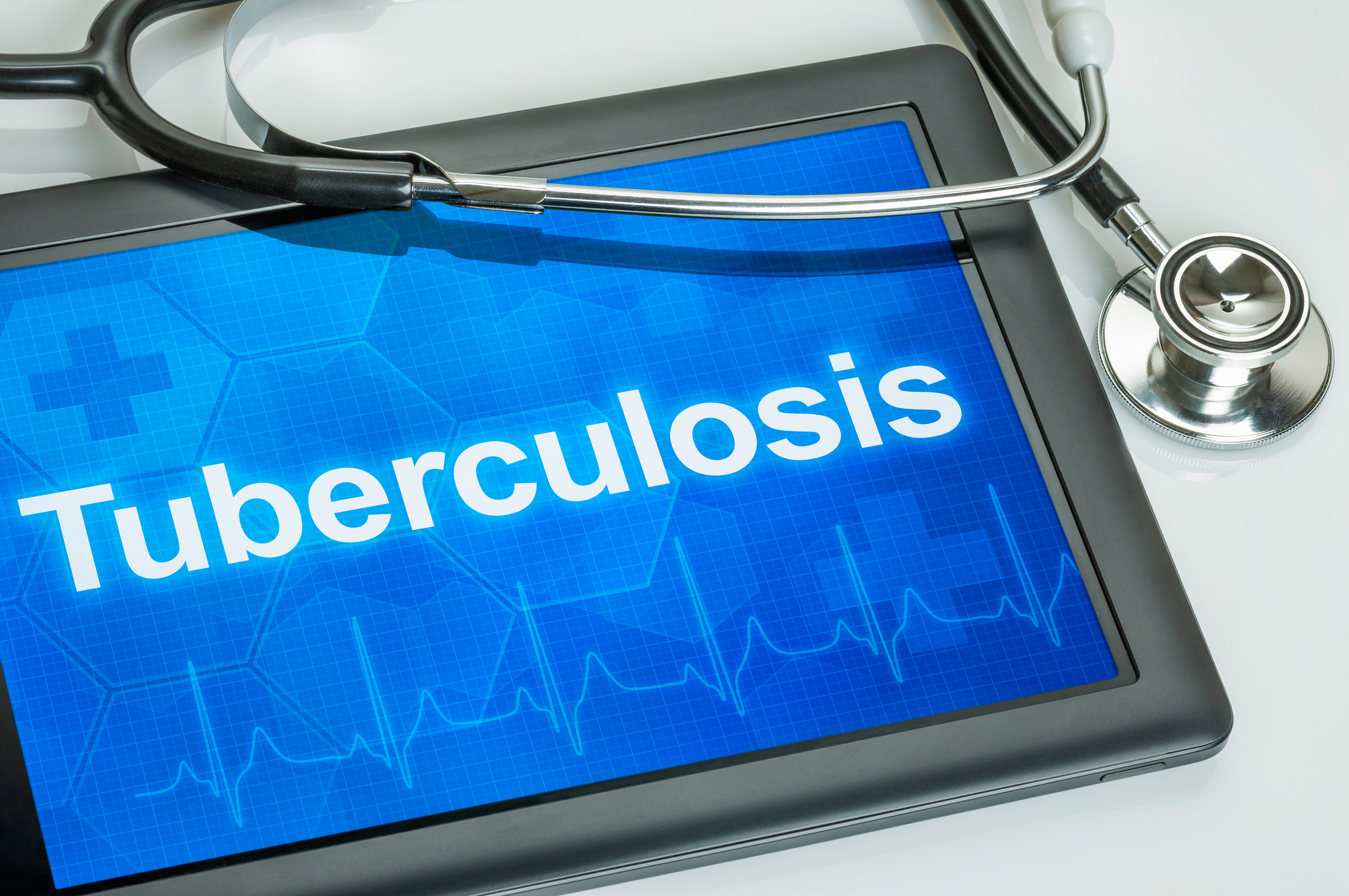 Tuberculosis | Fairfield County Health Department